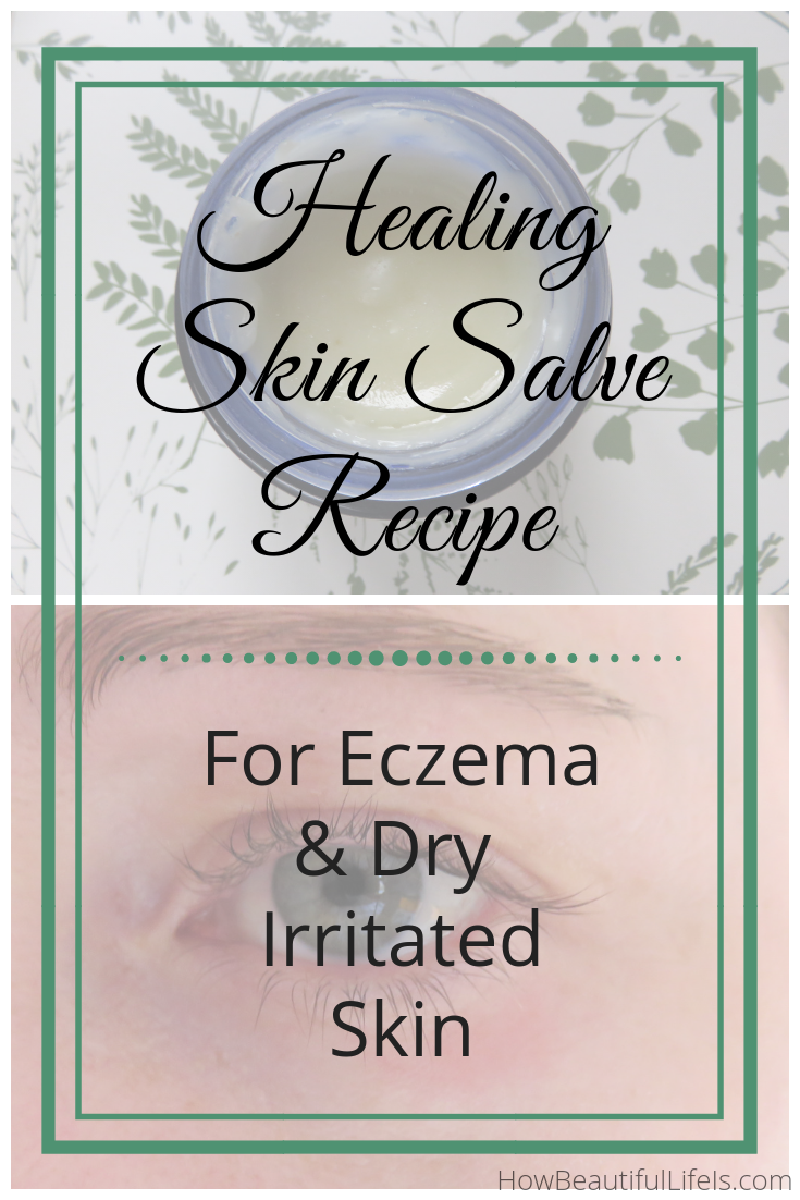 Natural Eczema Dry Skin Salve Recipe | How Beautiful Life Is